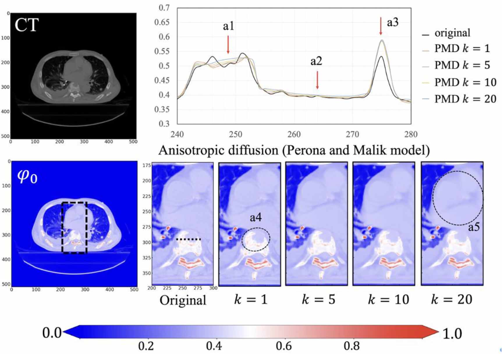 Diffusion equation quantification: selective enhancement algorithm for bone metastasis lesions ...