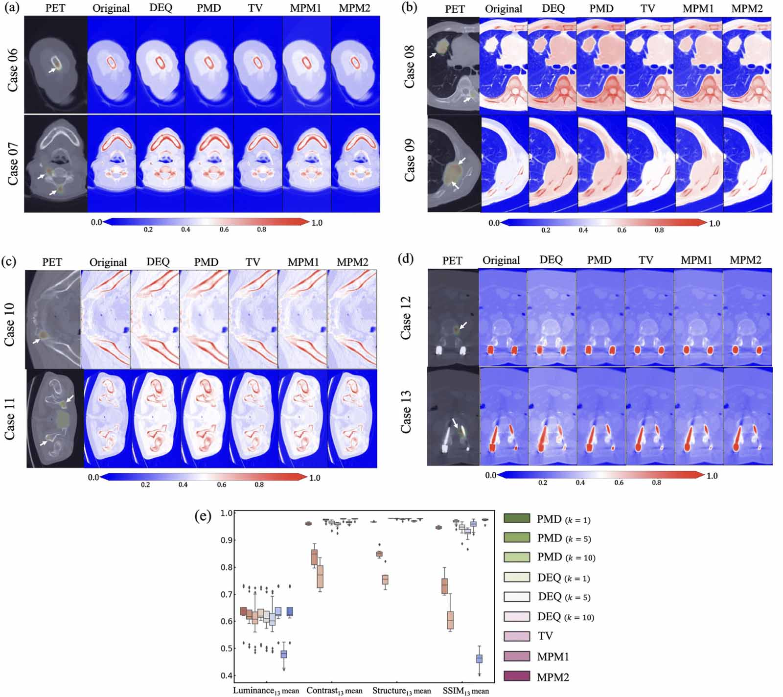 Diffusion equation quantification: selective enhancement algorithm for bone metastasis lesions ...