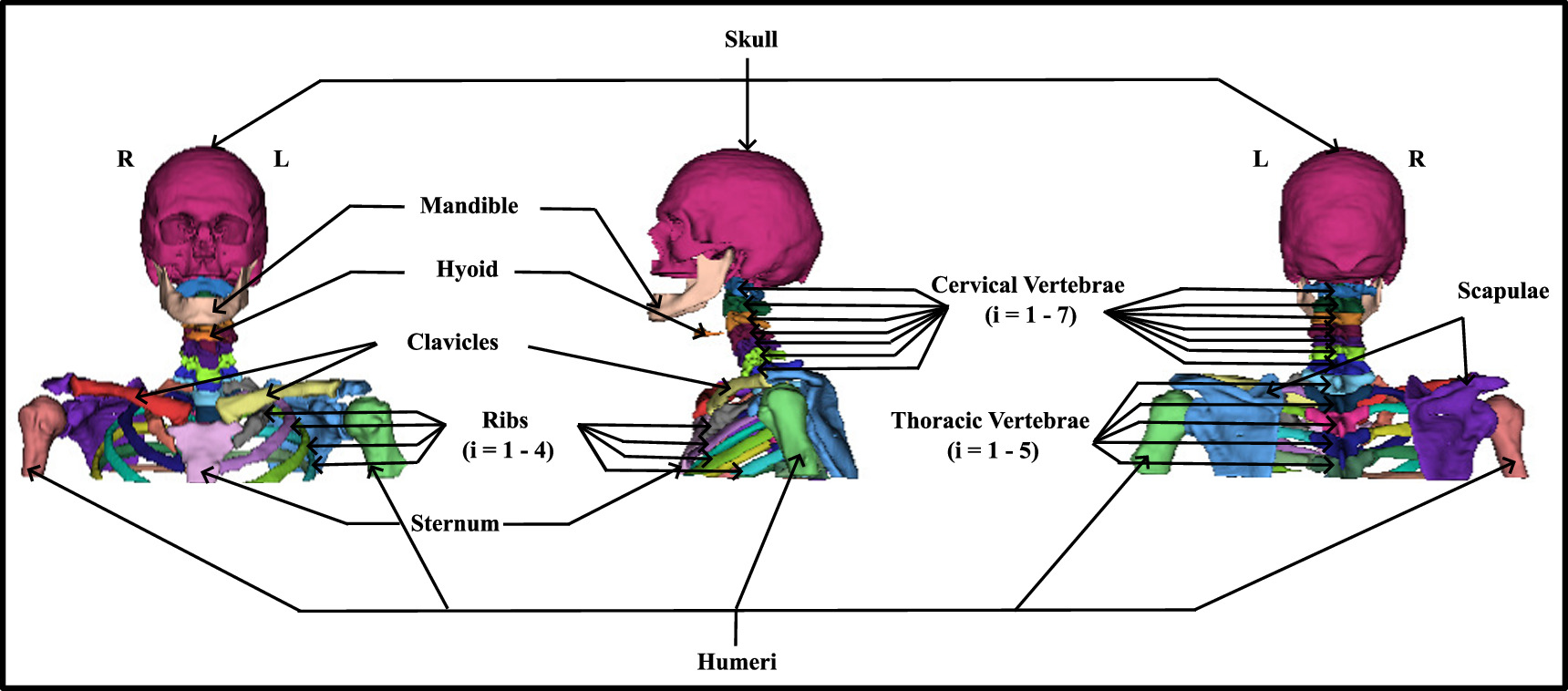 Essential parameters needed for a U-Net-based segmentation of individual bones on planning CT ...