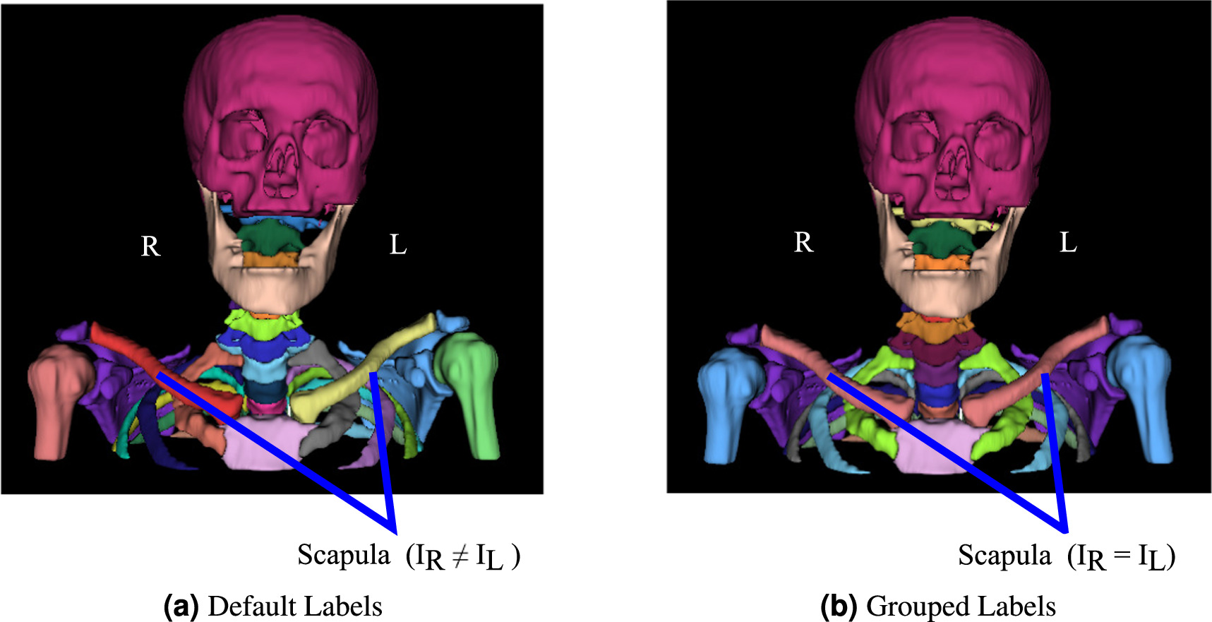 Essential parameters needed for a U-Net-based segmentation of individual bones on planning CT ...