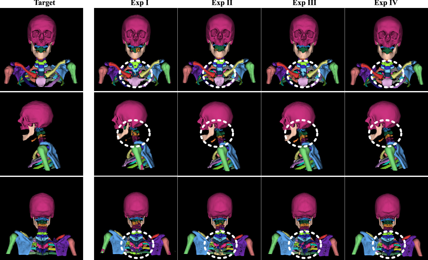 Essential parameters needed for a U-Net-based segmentation of individual bones on planning CT ...