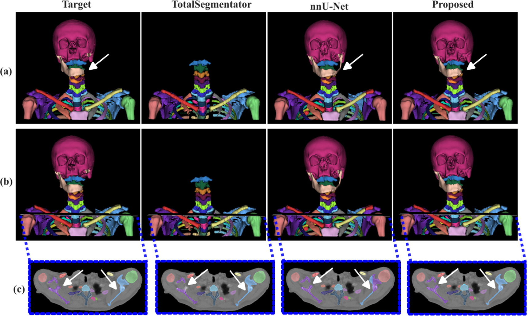 Essential parameters needed for a U-Net-based segmentation of ...