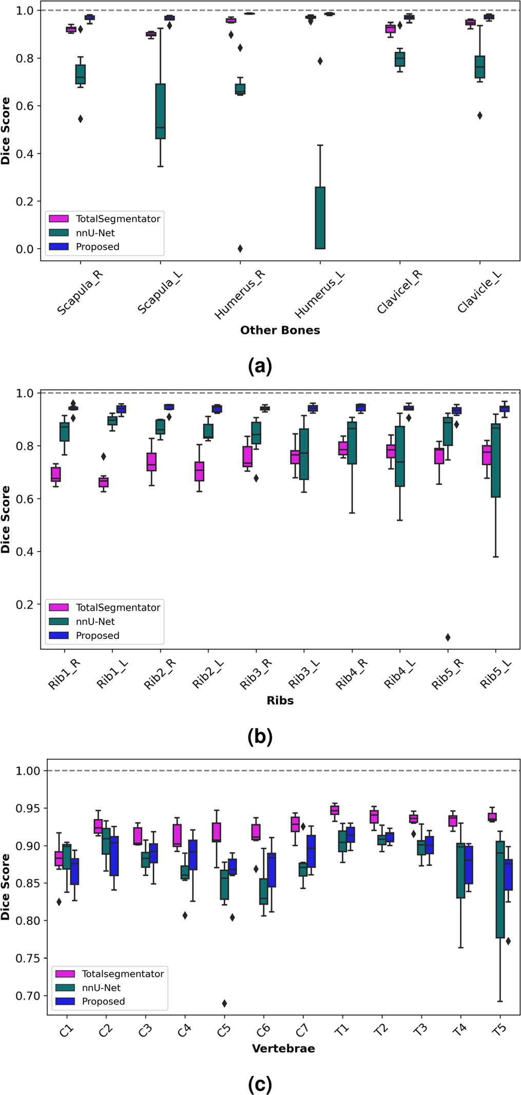 Essential parameters needed for a U-Net-based segmentation of individual bones on planning CT ...