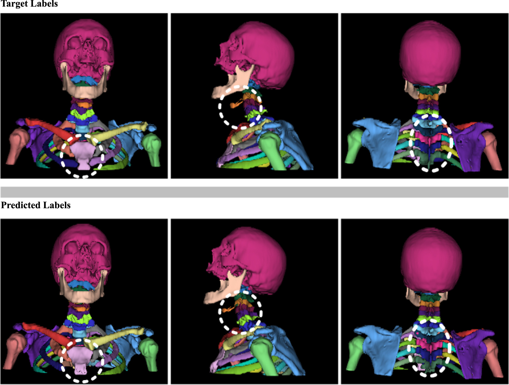 Essential parameters needed for a U-Net-based segmentation of individual bones on planning CT ...