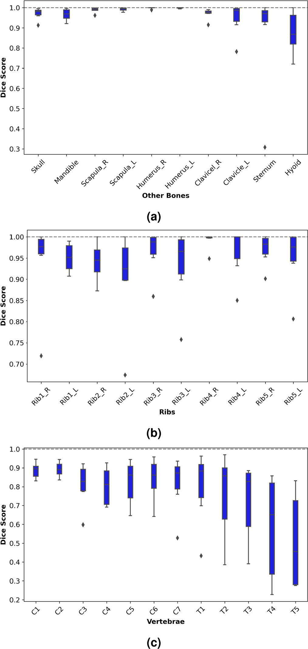 Essential parameters needed for a U-Net-based segmentation of individual bones on planning CT ...