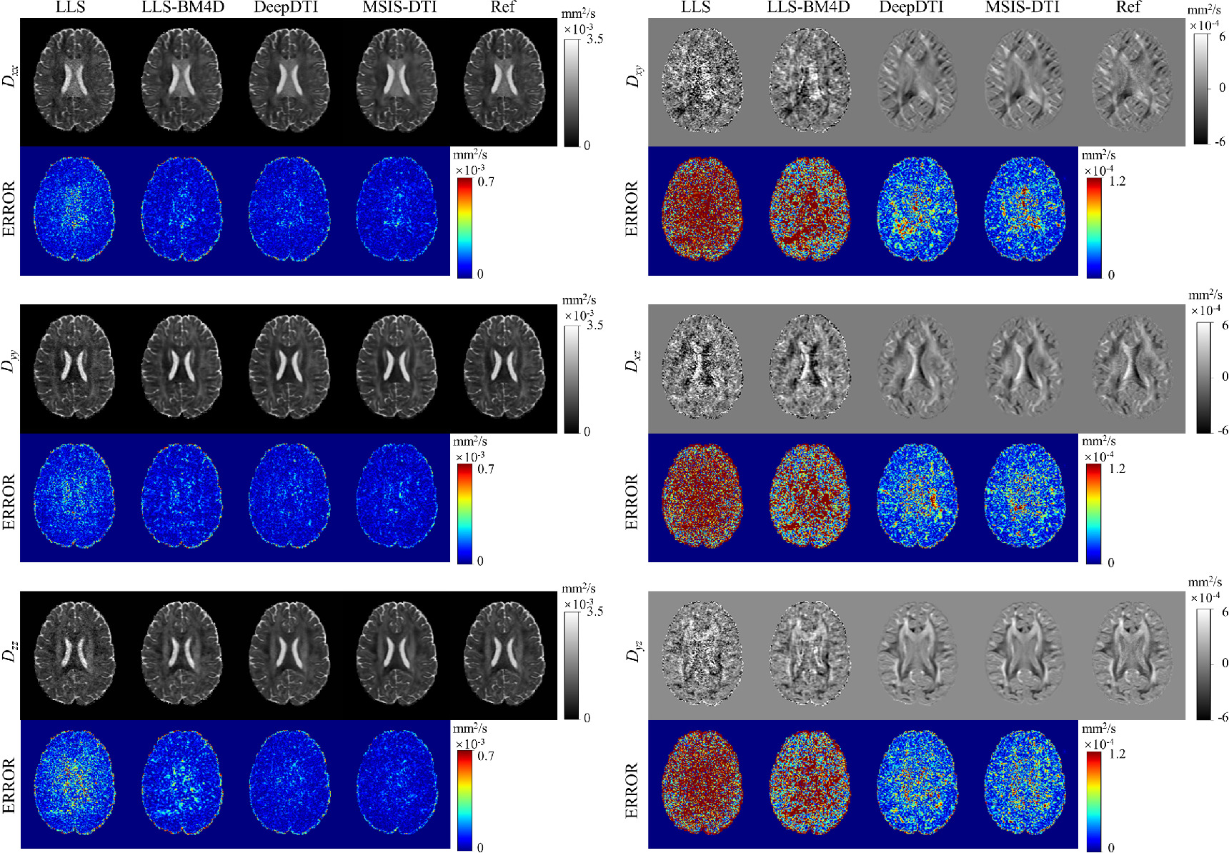 Ultrafast diffusion tensor imaging based on deep learning and multi ...