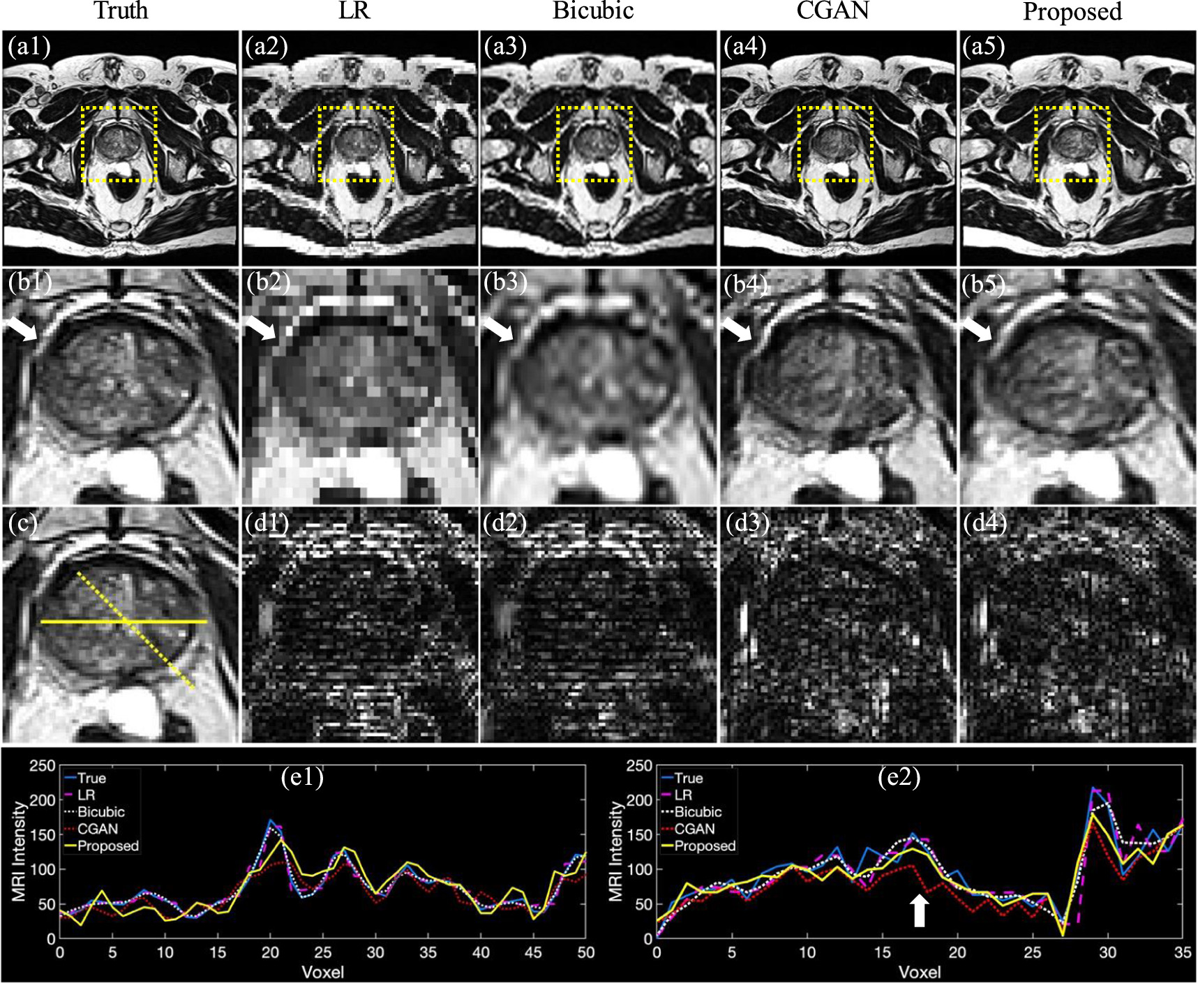 High-resolution MRI synthesis using a data-driven framework with denoising diffusion ...