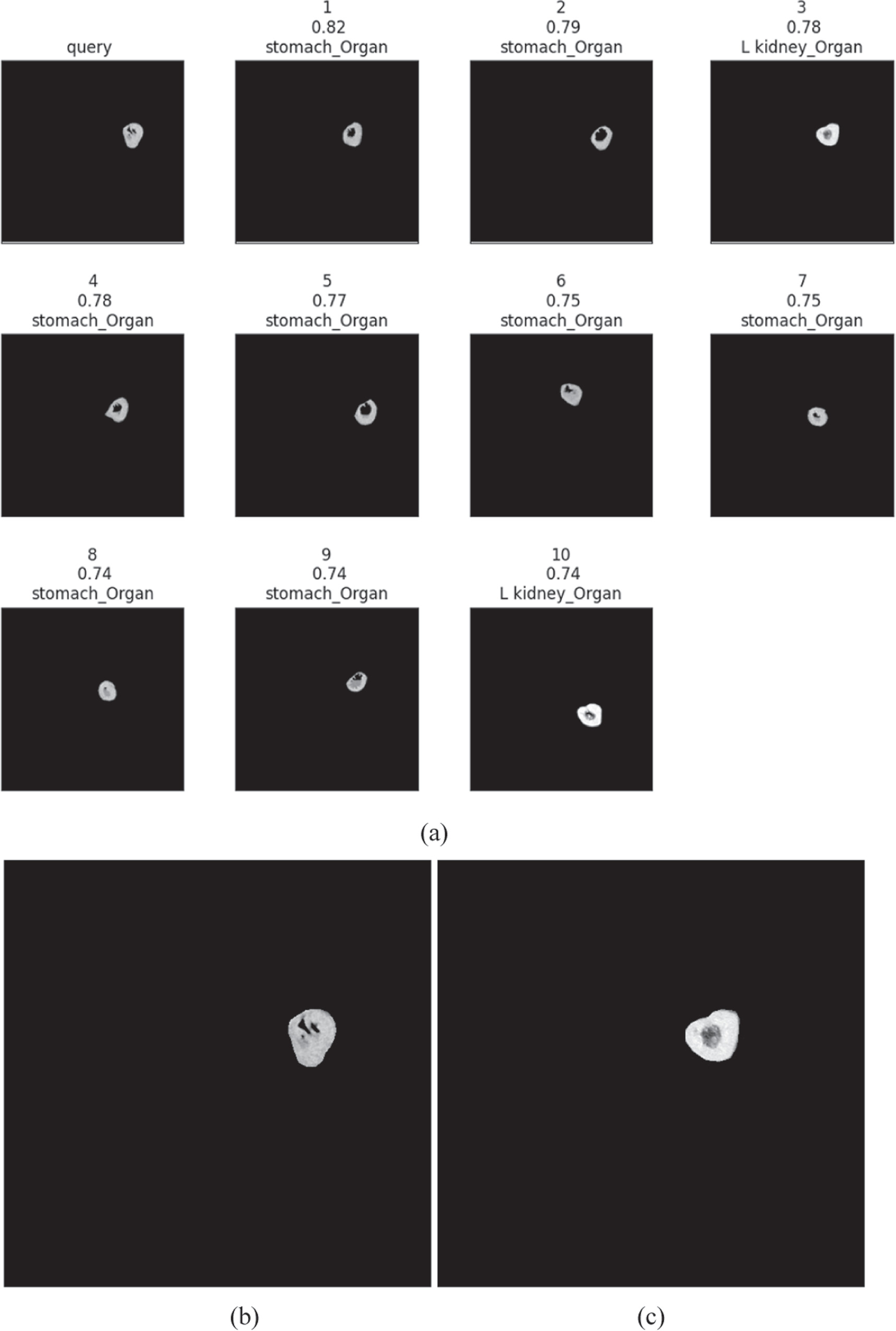 Interactive content-based image retrieval with deep learning for CT ...