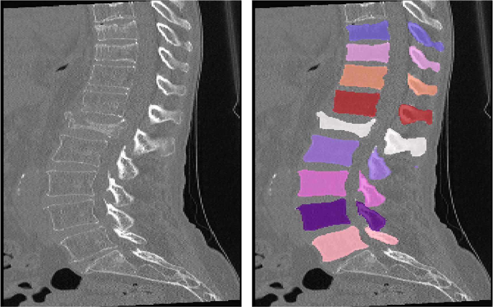 Interactive segmentation of medical images using deep learning - IOPscience