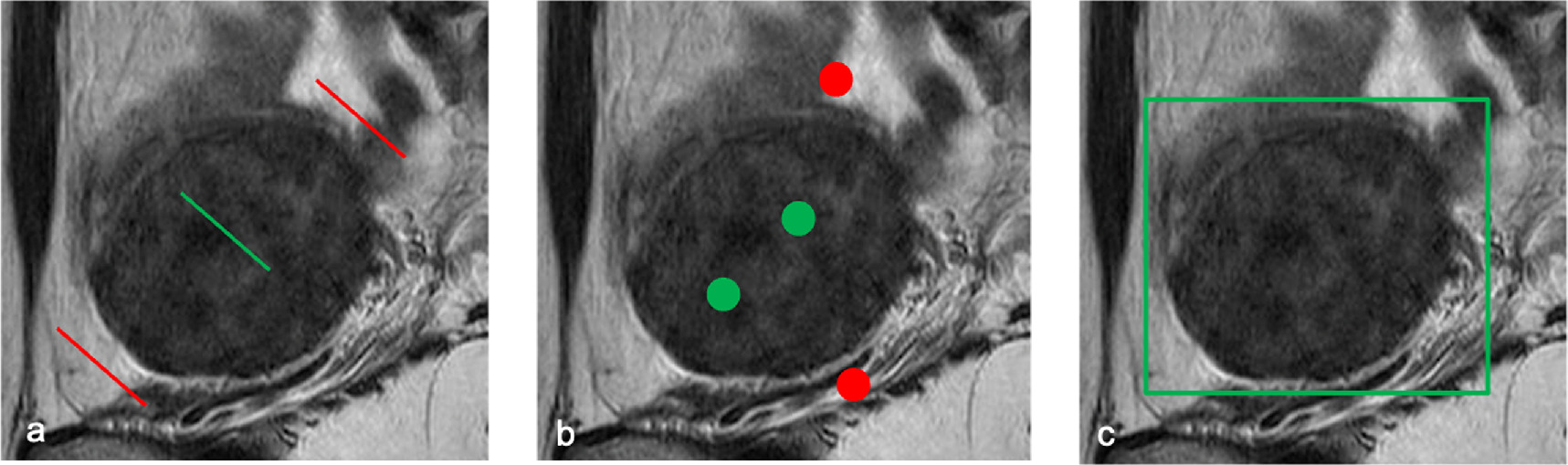 Interactive segmentation of medical images using deep learning - IOPscience