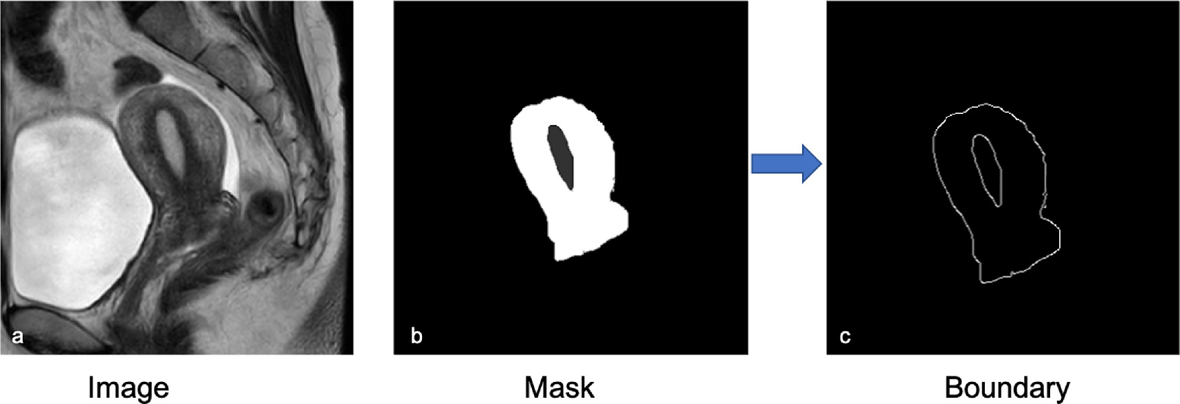 Interactive segmentation of medical images using deep learning - IOPscience
