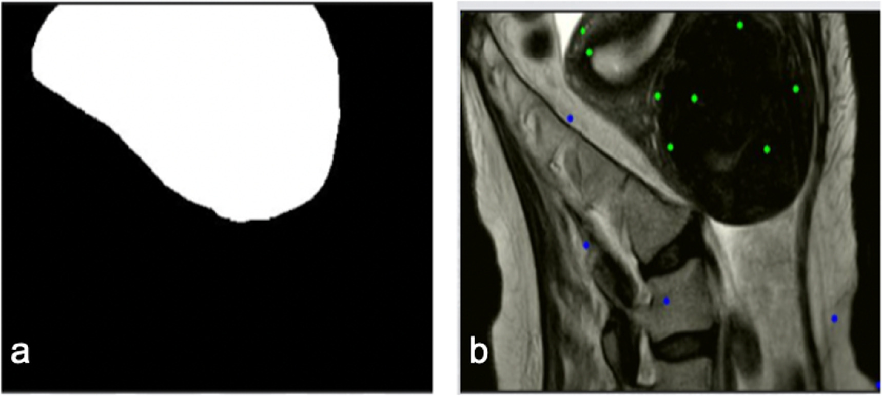 Interactive segmentation of medical images using deep learning - IOPscience