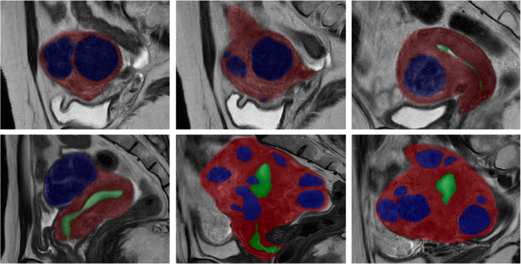 Interactive segmentation of medical images using deep learning - IOPscience