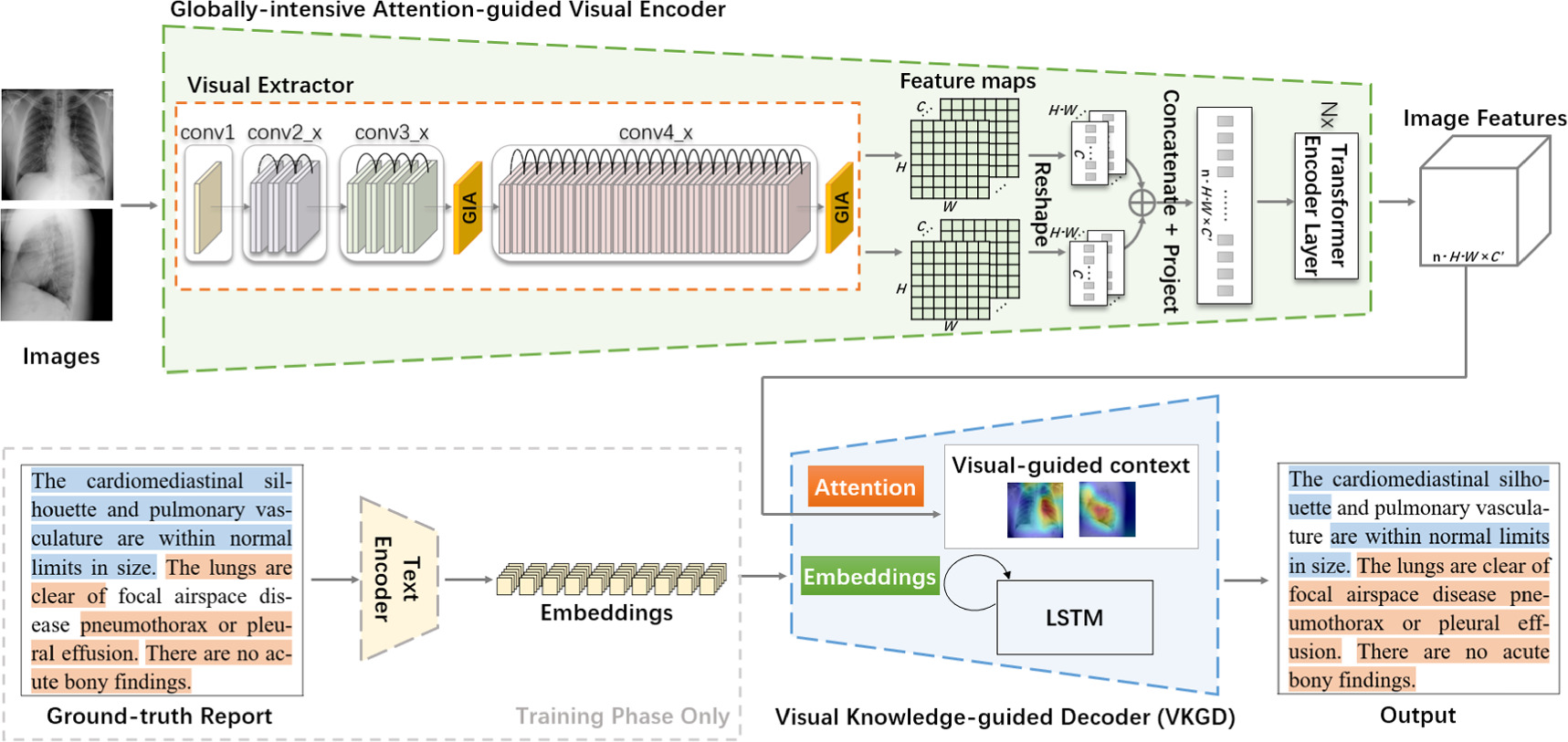 Intensive vision-guided network for radiology report generation ...