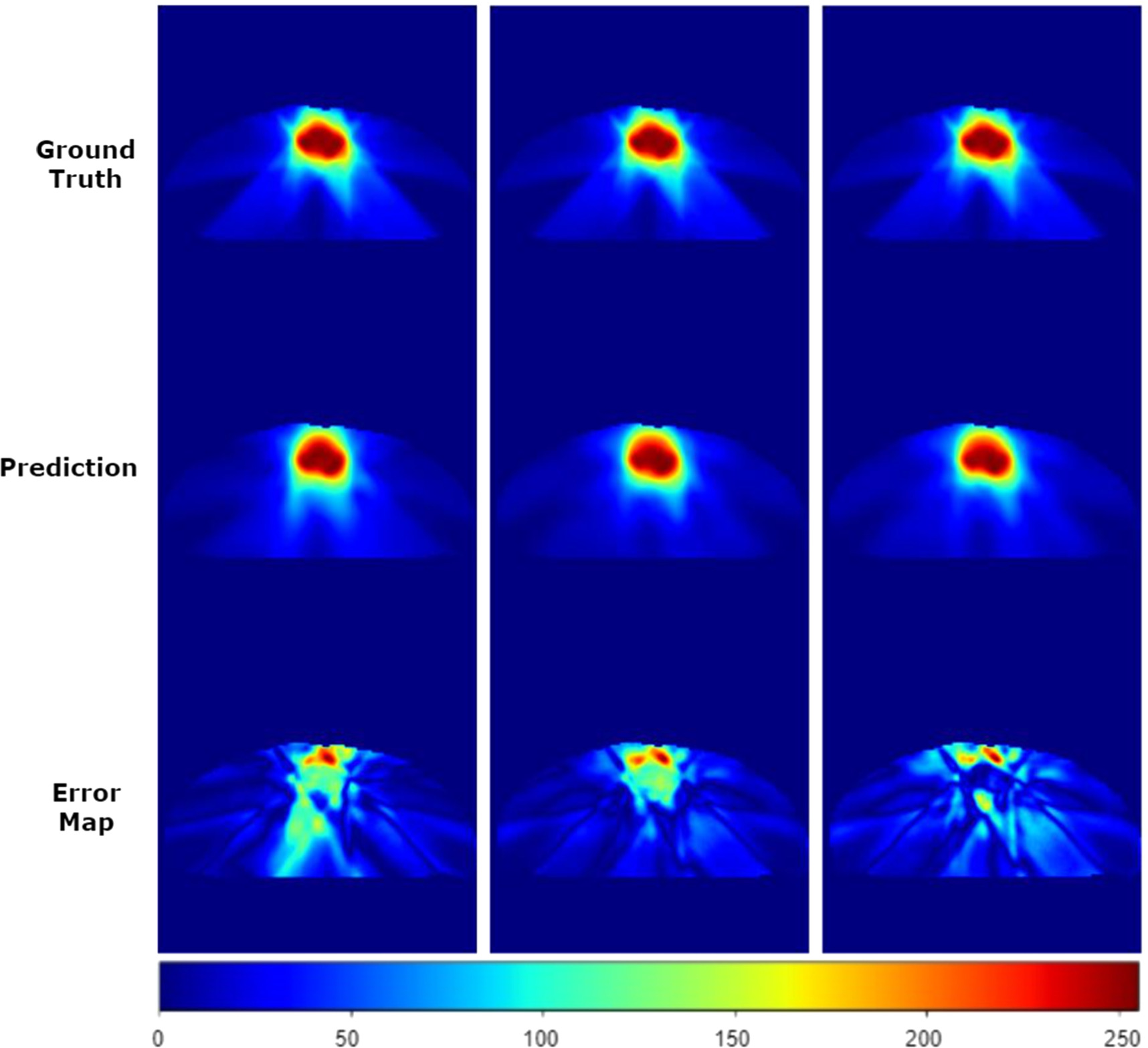 A cascade transformer-based model for 3D dose distribution prediction ...