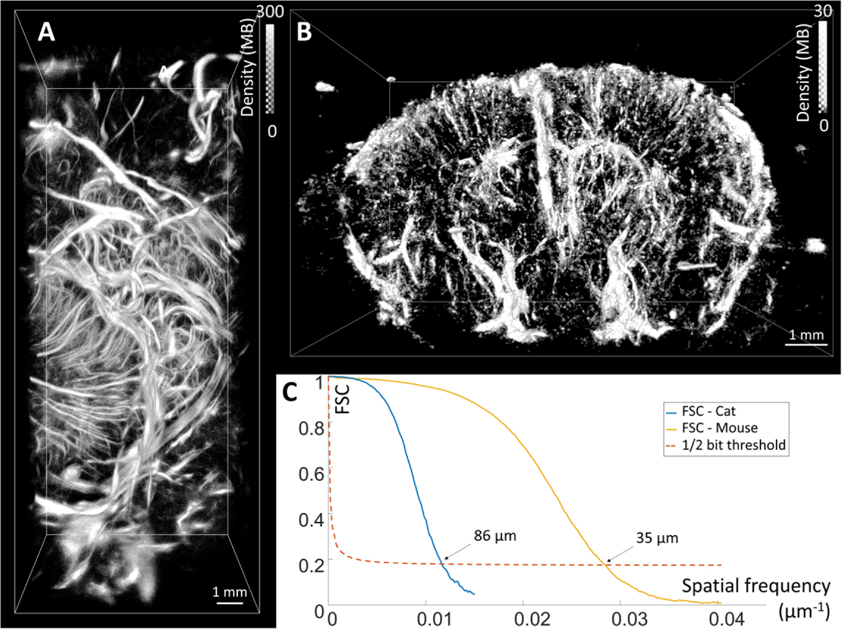 Quantitative pulsatility measurements using 3D dynamic ultrasound ...