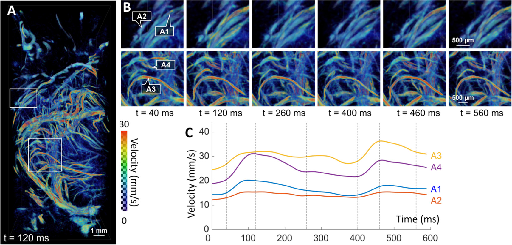Quantitative pulsatility measurements using 3D dynamic ultrasound ...
