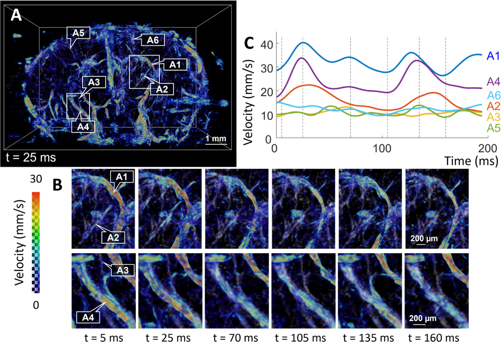 Quantitative pulsatility measurements using 3D dynamic ultrasound ...