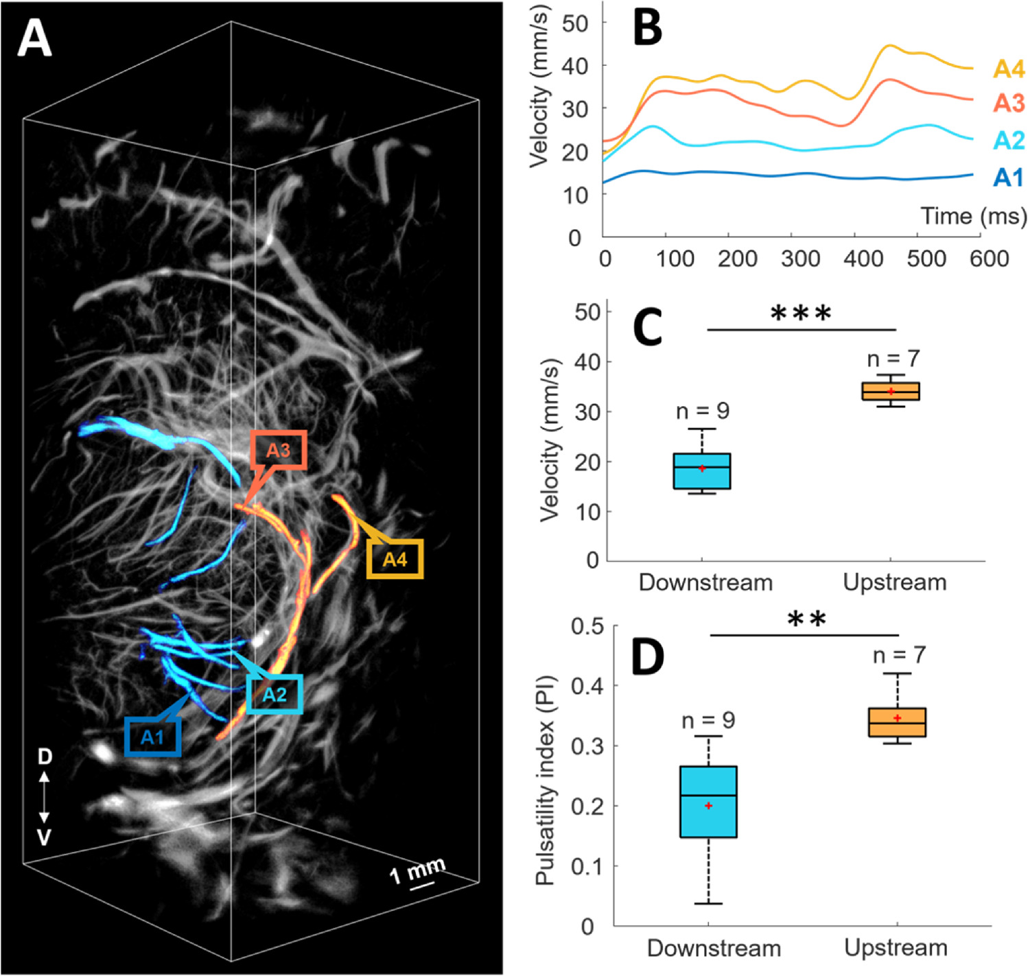Quantitative pulsatility measurements using 3D dynamic ultrasound ...