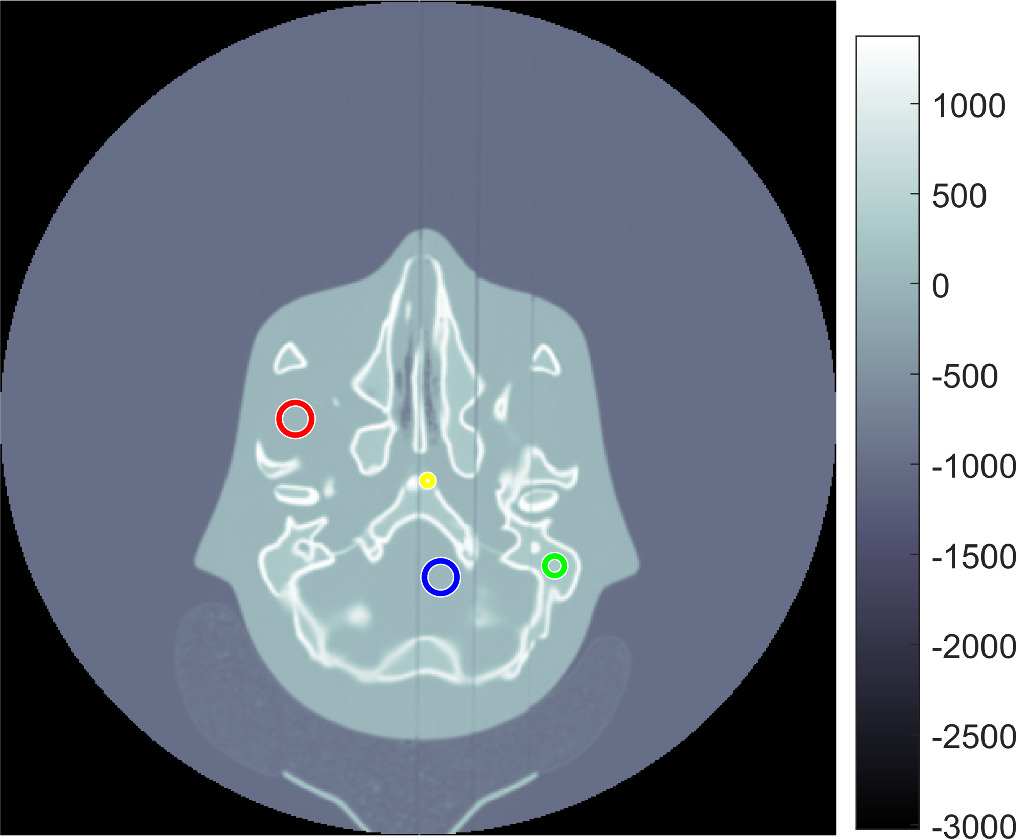 Material decomposition maps based calibration of dual energy CT ...
