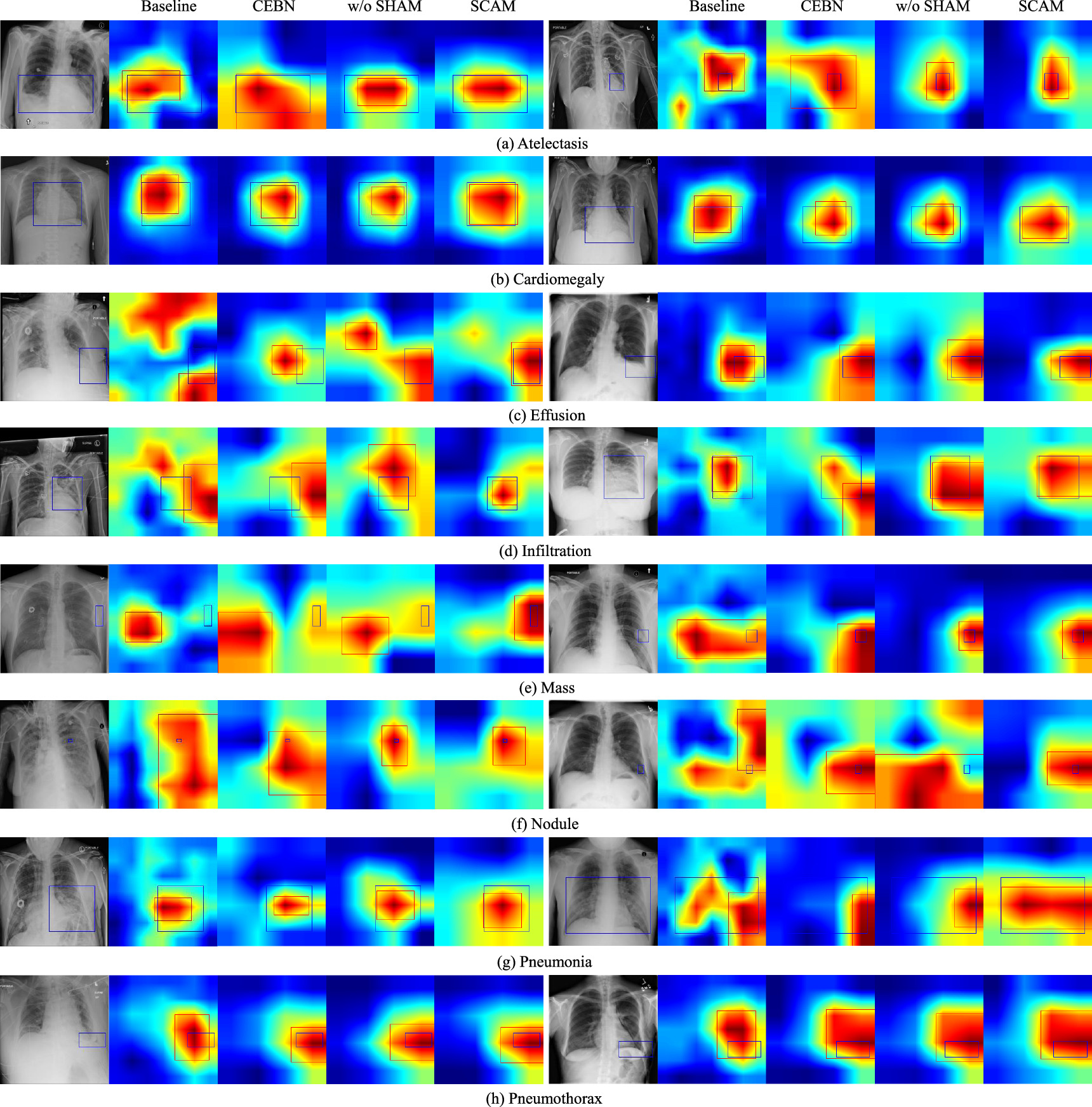 Chest x-ray diagnosis via spatial-channel high-order attention ...
