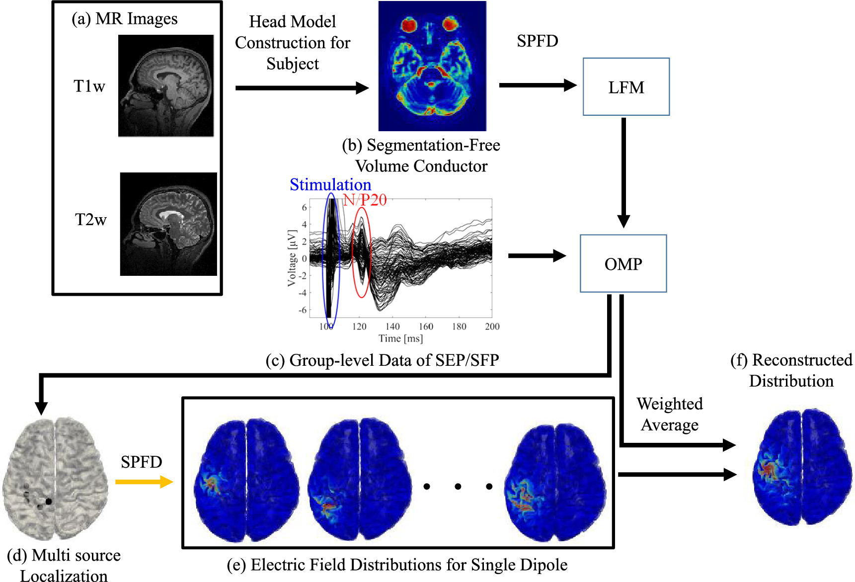 High-resolution EEG source localization in personalized segmentation-free head model with multi ...