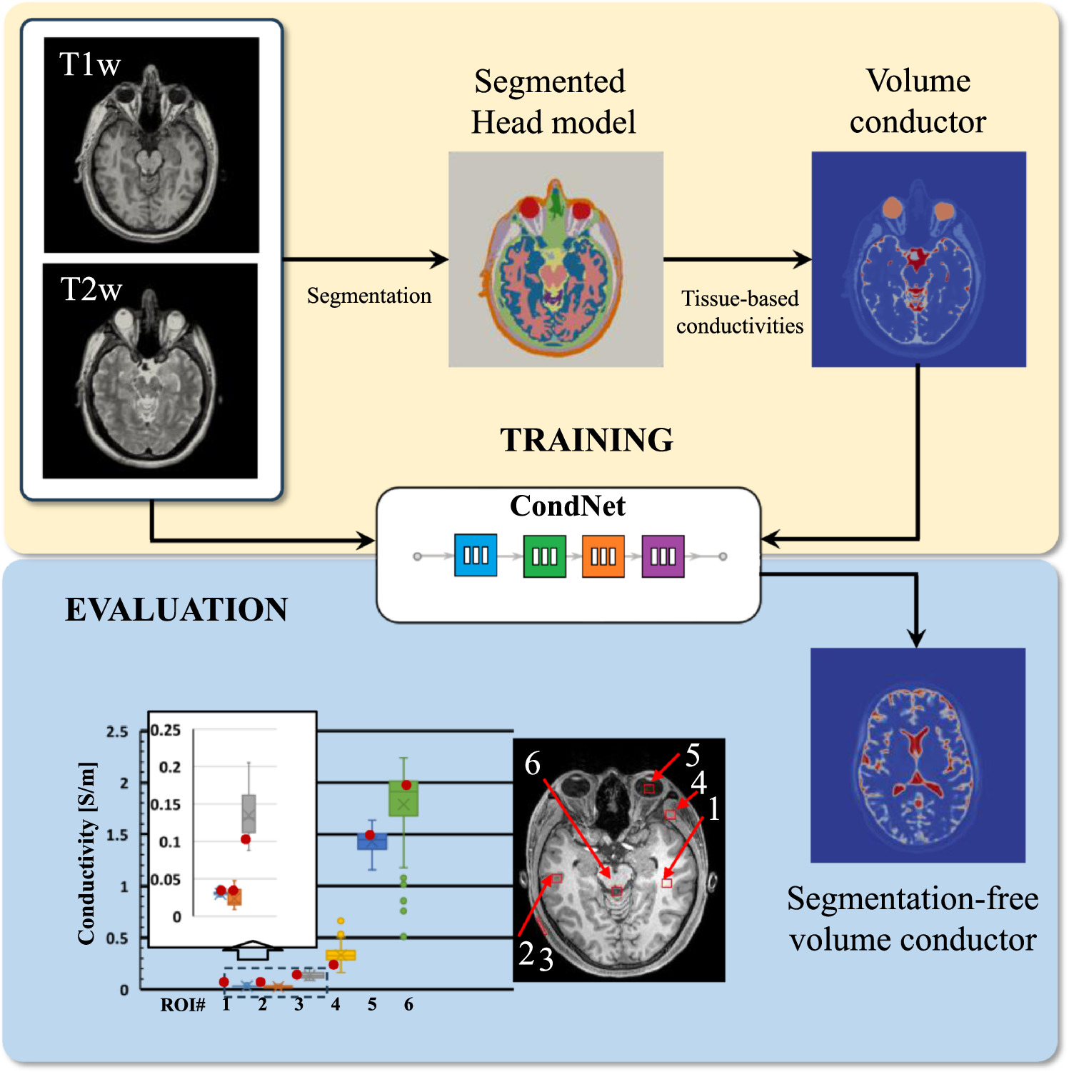 High-resolution EEG source localization in personalized segmentation ...