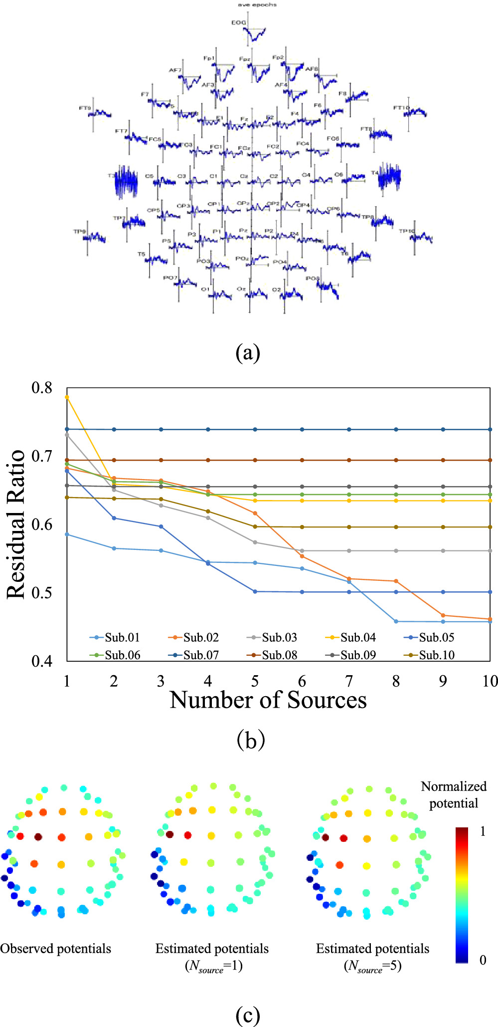 High-resolution EEG source localization in personalized segmentation ...