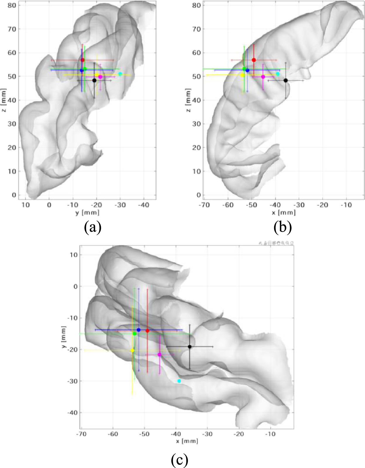 High-resolution EEG source localization in personalized segmentation ...