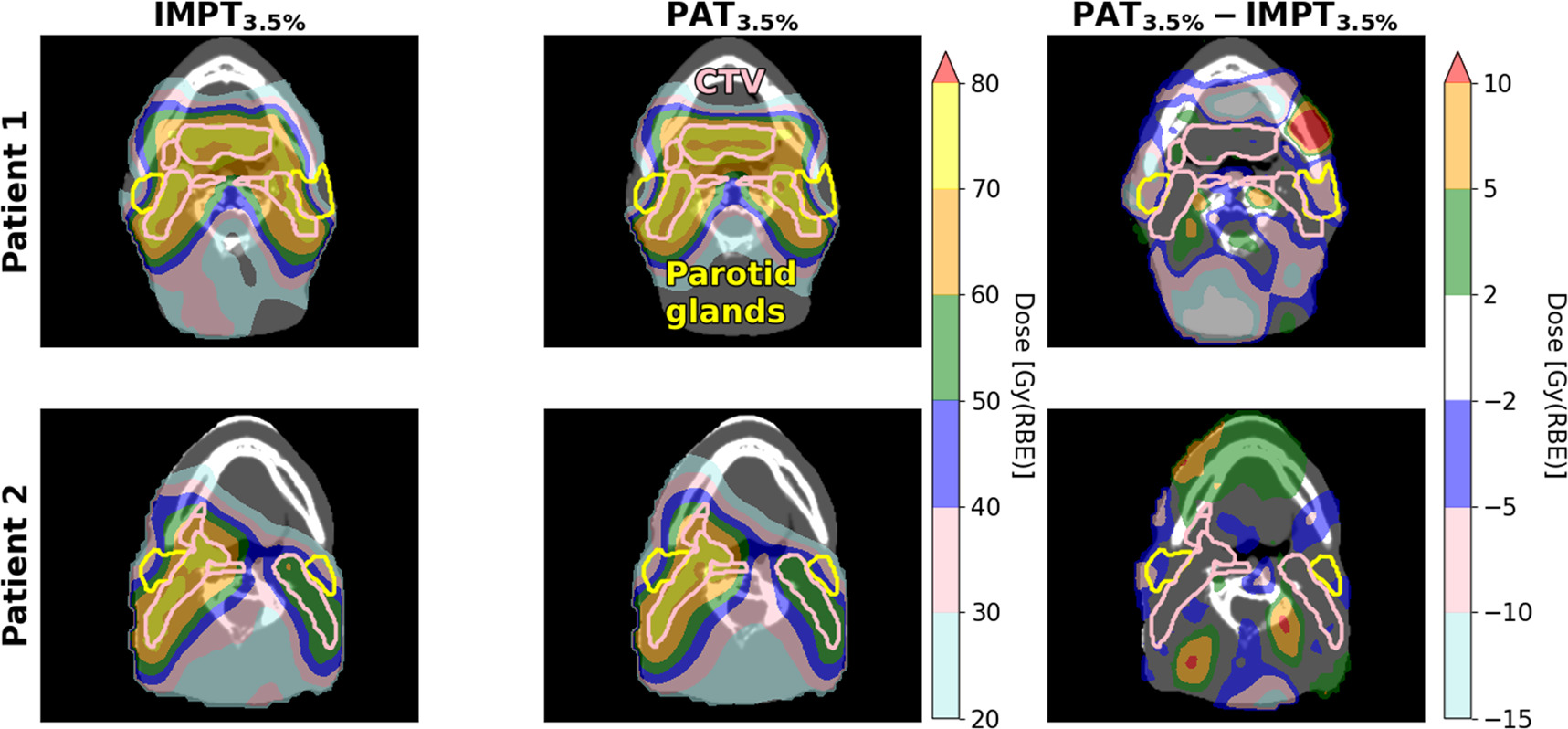 Impact of and interplay between proton arc therapy and range ...