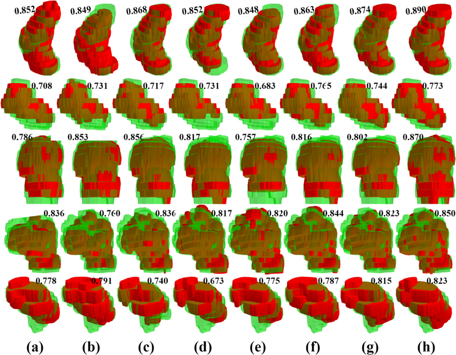 TdDS-UNet: top-down deeply supervised U-Net for the delineation of 3D ...