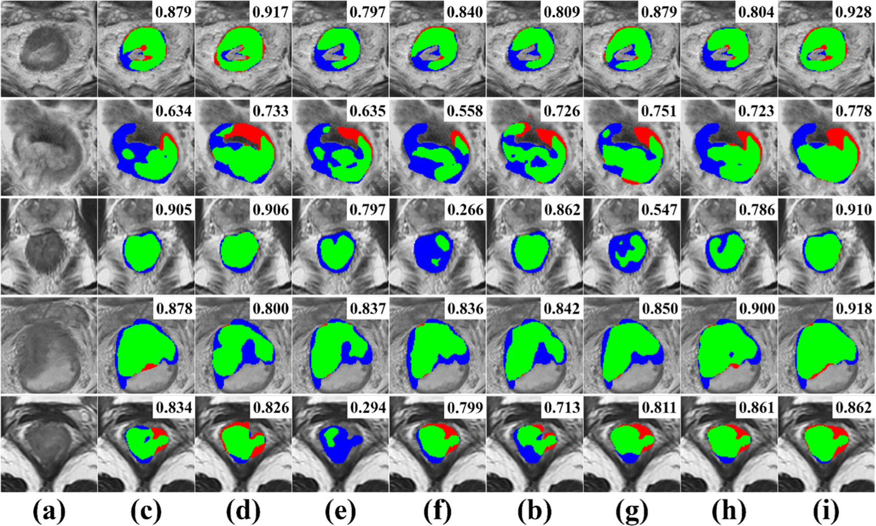 TdDS-UNet: top-down deeply supervised U-Net for the delineation of 3D ...