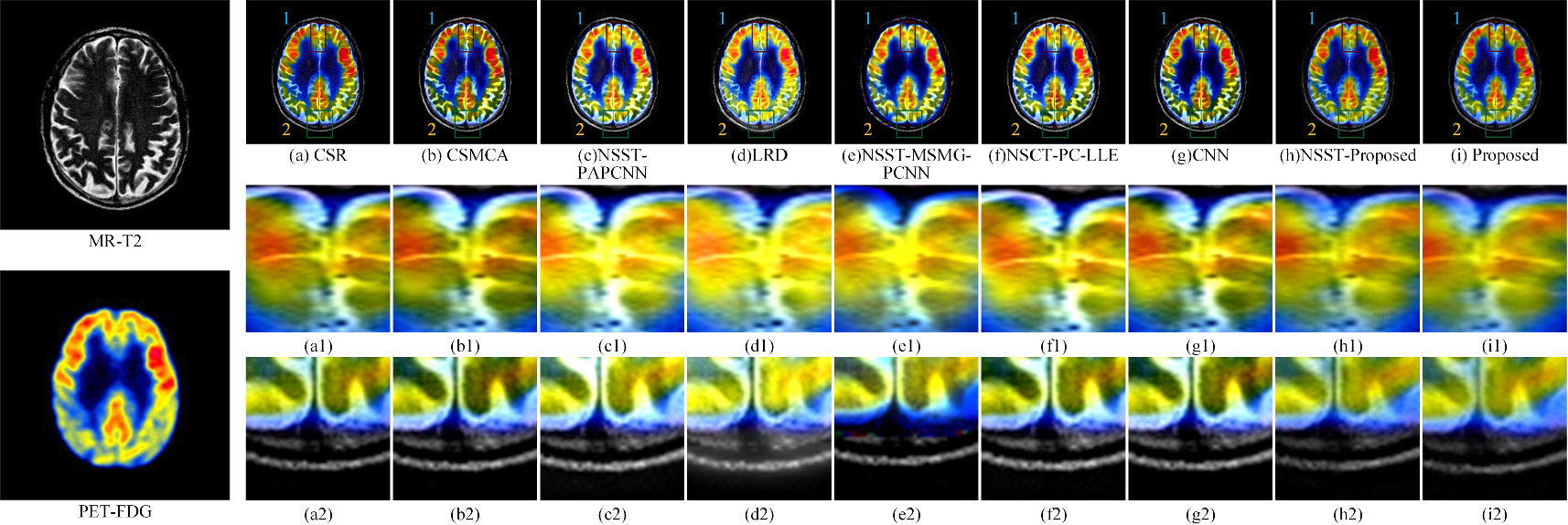Adaptive convolutional sparsity with sub-band correlation in the NSCT ...
