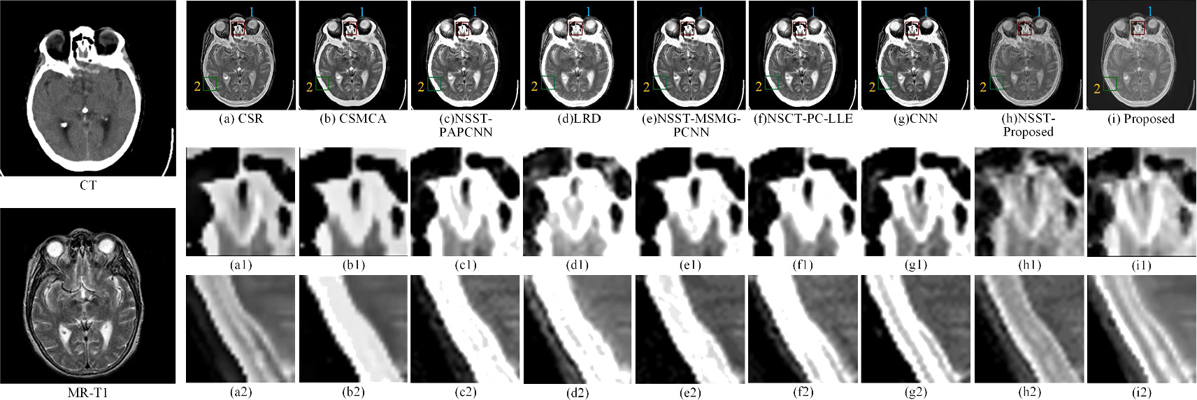 Adaptive convolutional sparsity with sub-band correlation in the NSCT ...