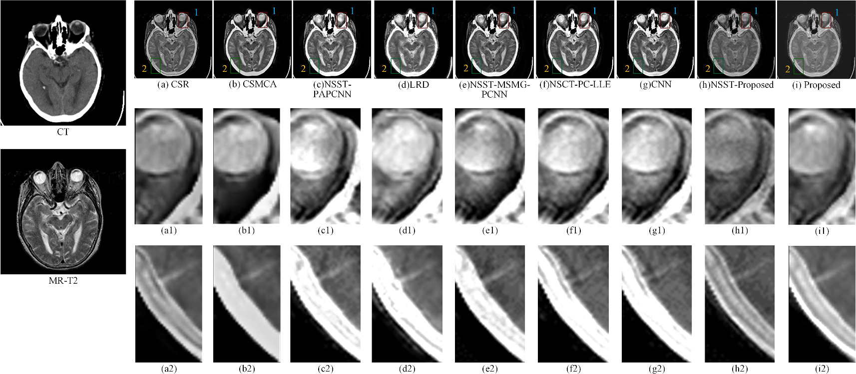 Adaptive convolutional sparsity with sub-band correlation in the NSCT ...