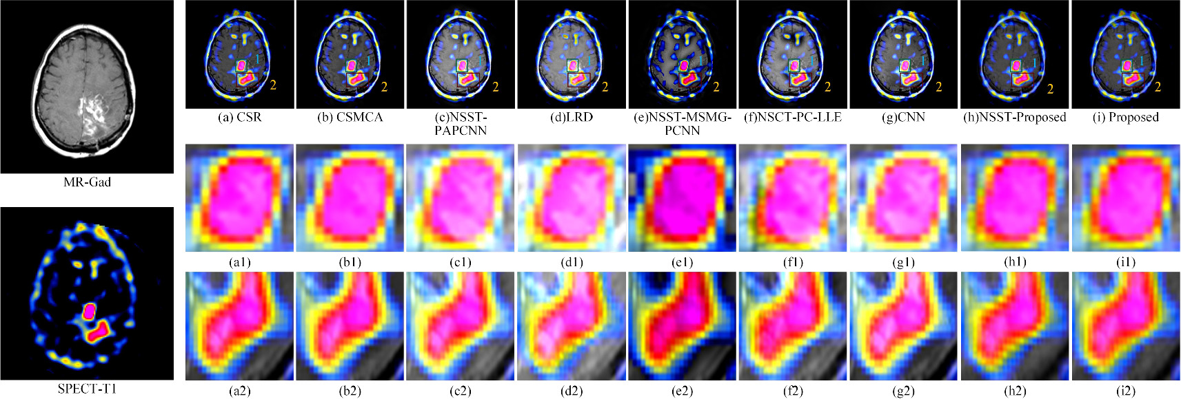 Adaptive convolutional sparsity with sub-band correlation in the NSCT ...