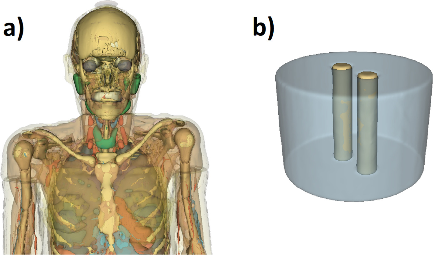 Time-of-flight scatter rejection in x-ray radiography - IOPscience