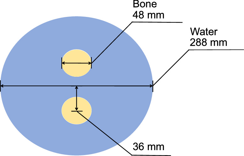 Time-of-flight scatter rejection in x-ray radiography - IOPscience