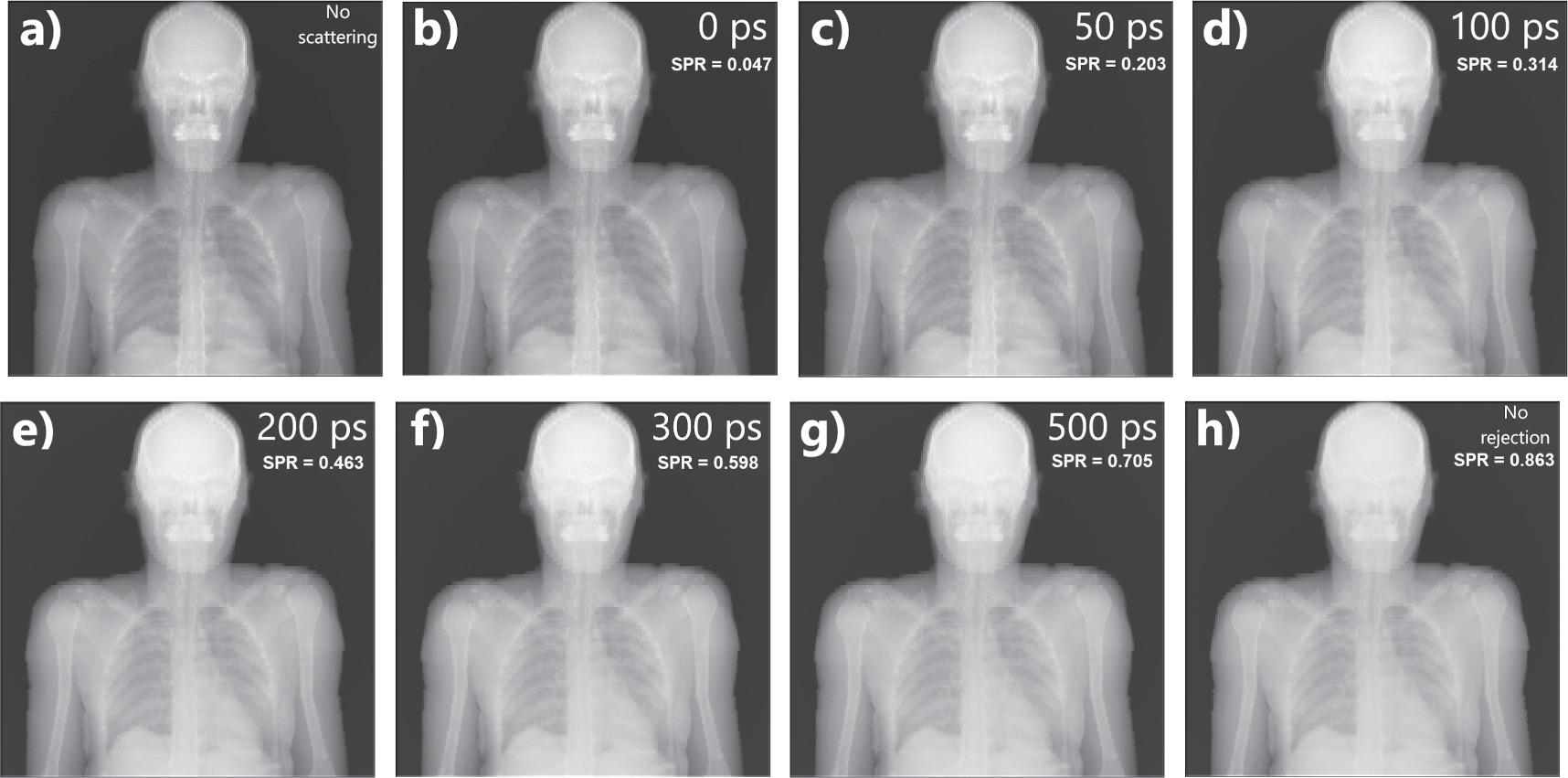 Time-of-flight scatter rejection in x-ray radiography - IOPscience