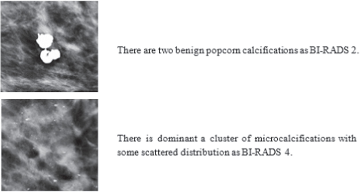 Radioport: a radiomics-reporting network for interpretable deep ...