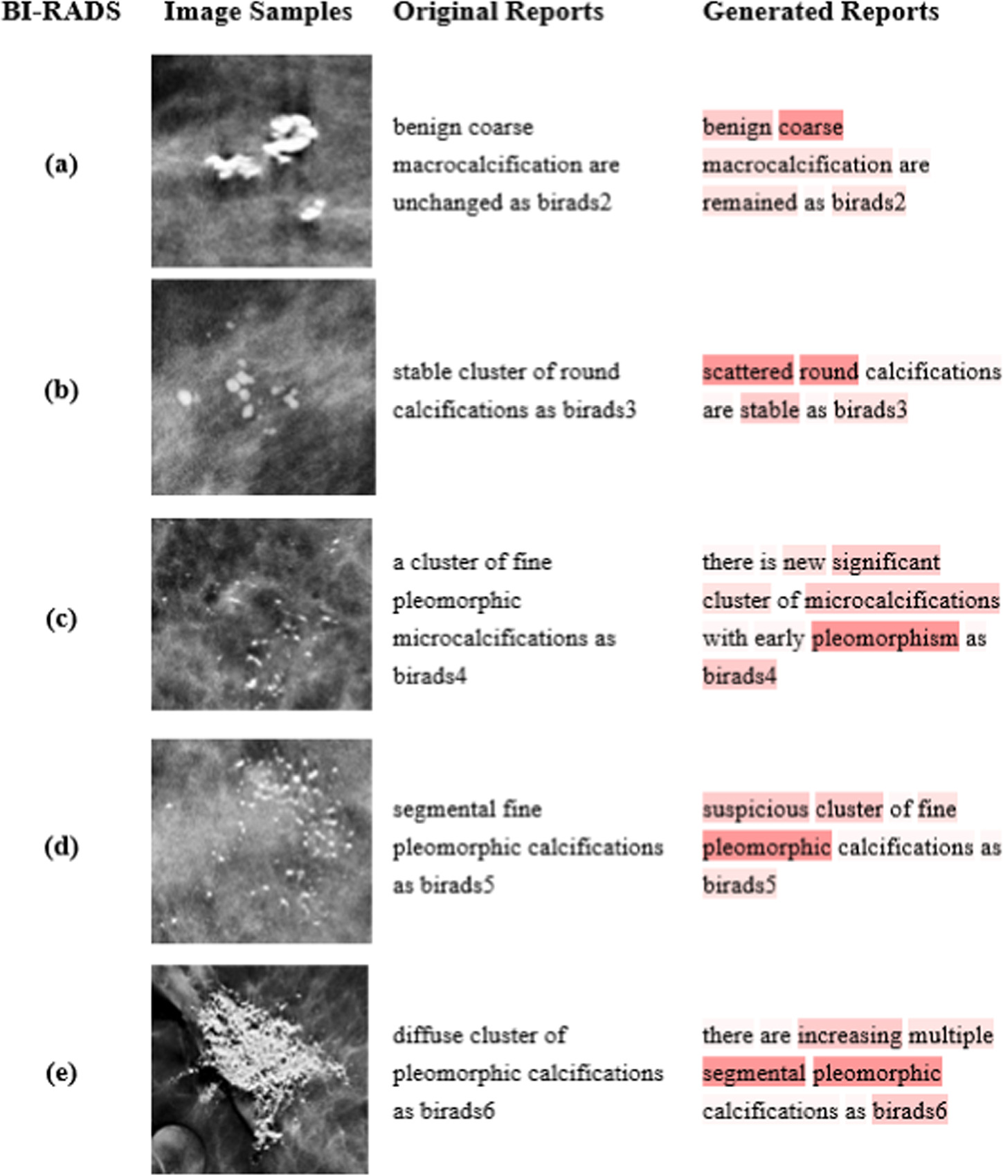 Radioport: a radiomics-reporting network for interpretable deep ...