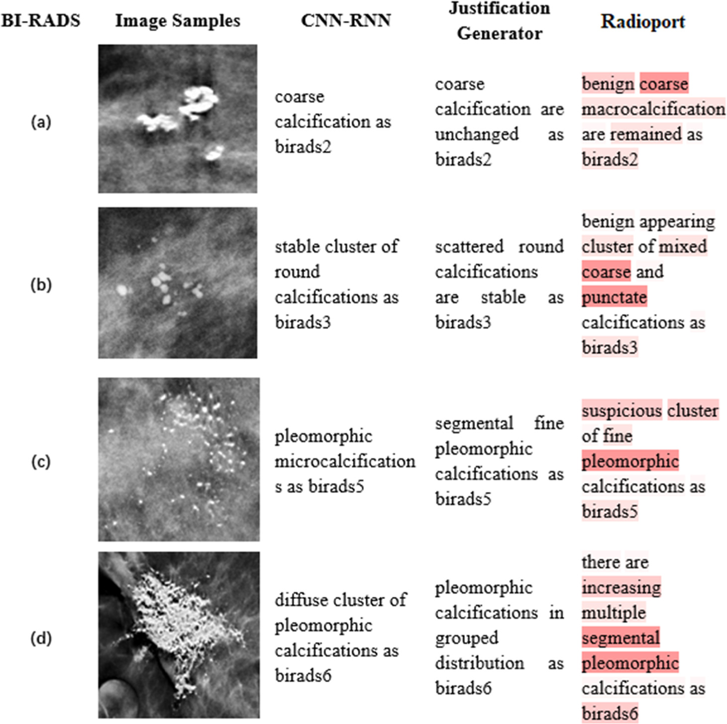 Radioport: a radiomics-reporting network for interpretable deep learning in BI-RADS ...