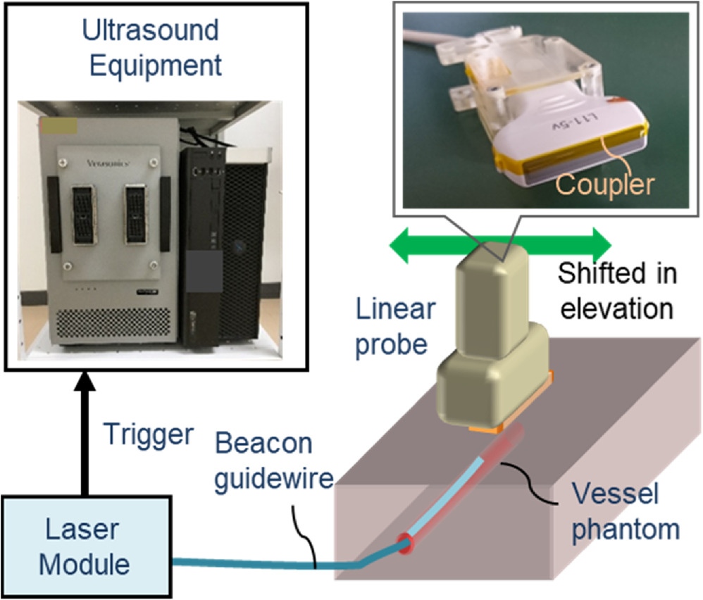 Split-based elevational localization of photoacoustic guidewire tip by ...