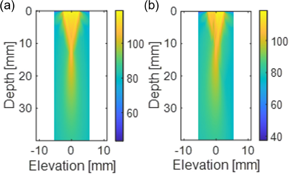 Split-based elevational localization of photoacoustic guidewire tip by ...
