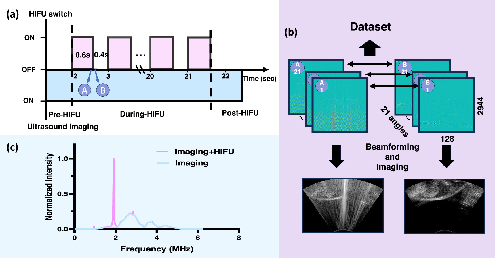 Suppressing HIFU interference in ultrasound images using 1D U-Net-based ...