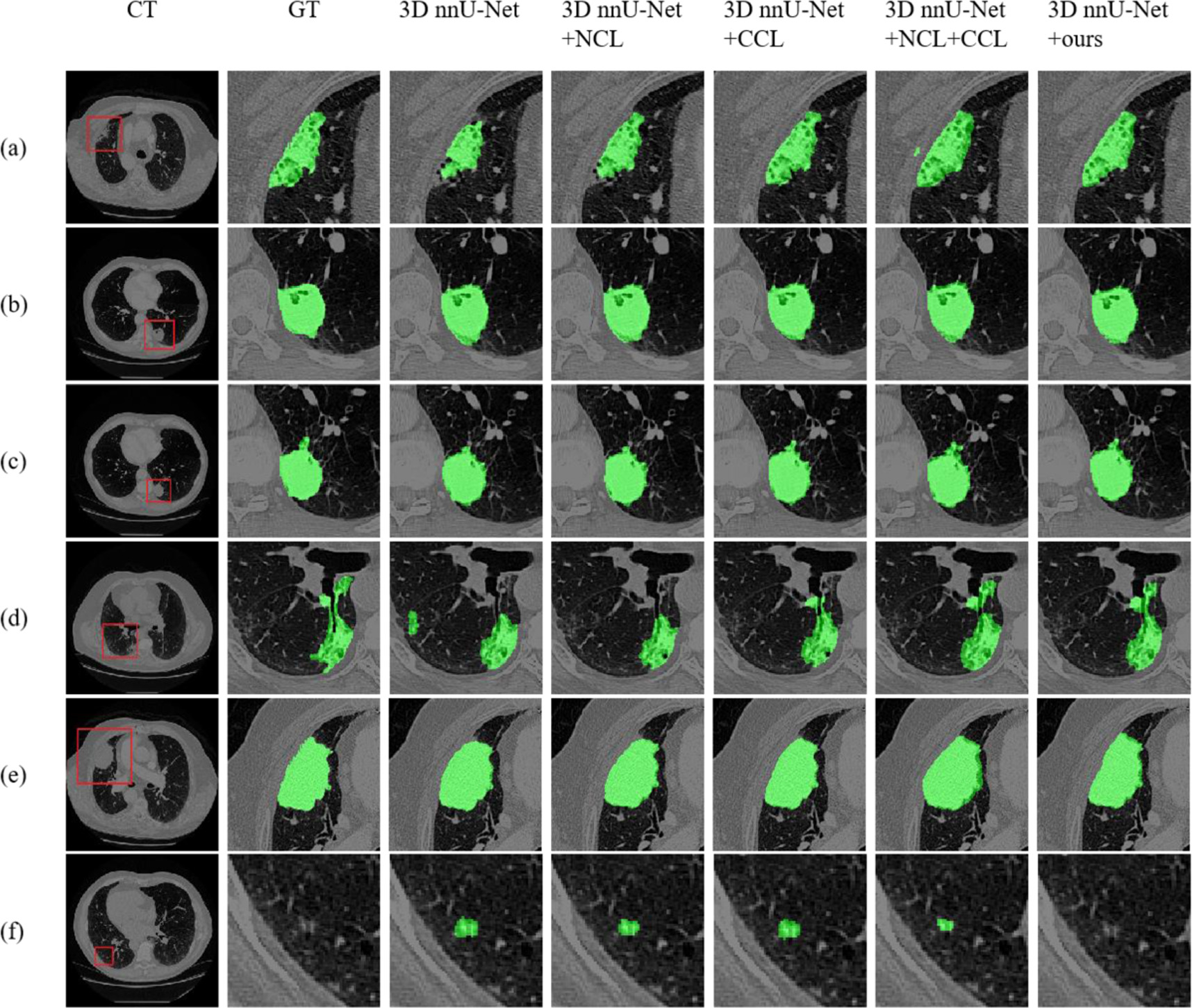 Mutually enhanced multi-view information learning for segmentation of ...