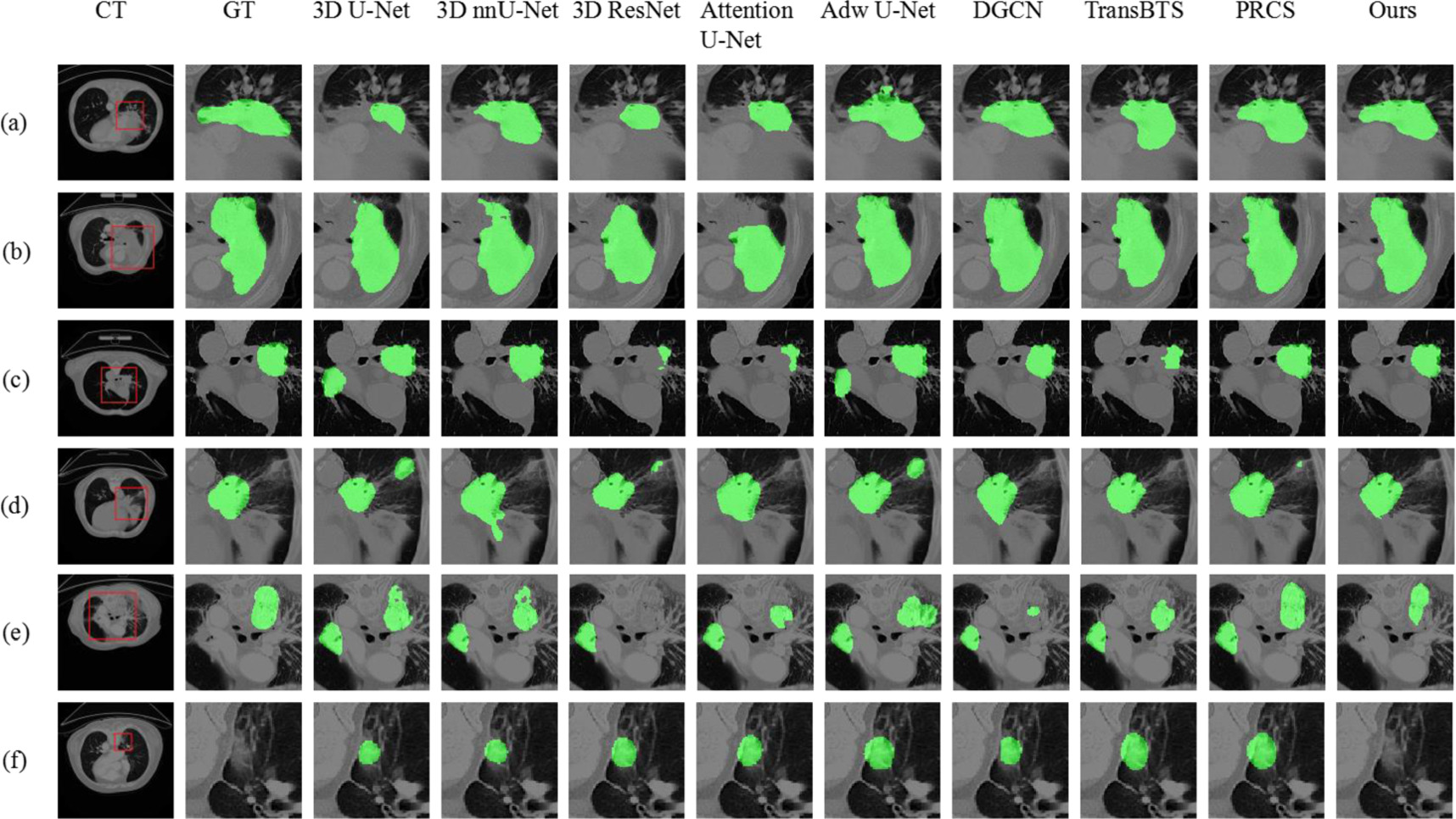 Mutually enhanced multi-view information learning for segmentation of ...