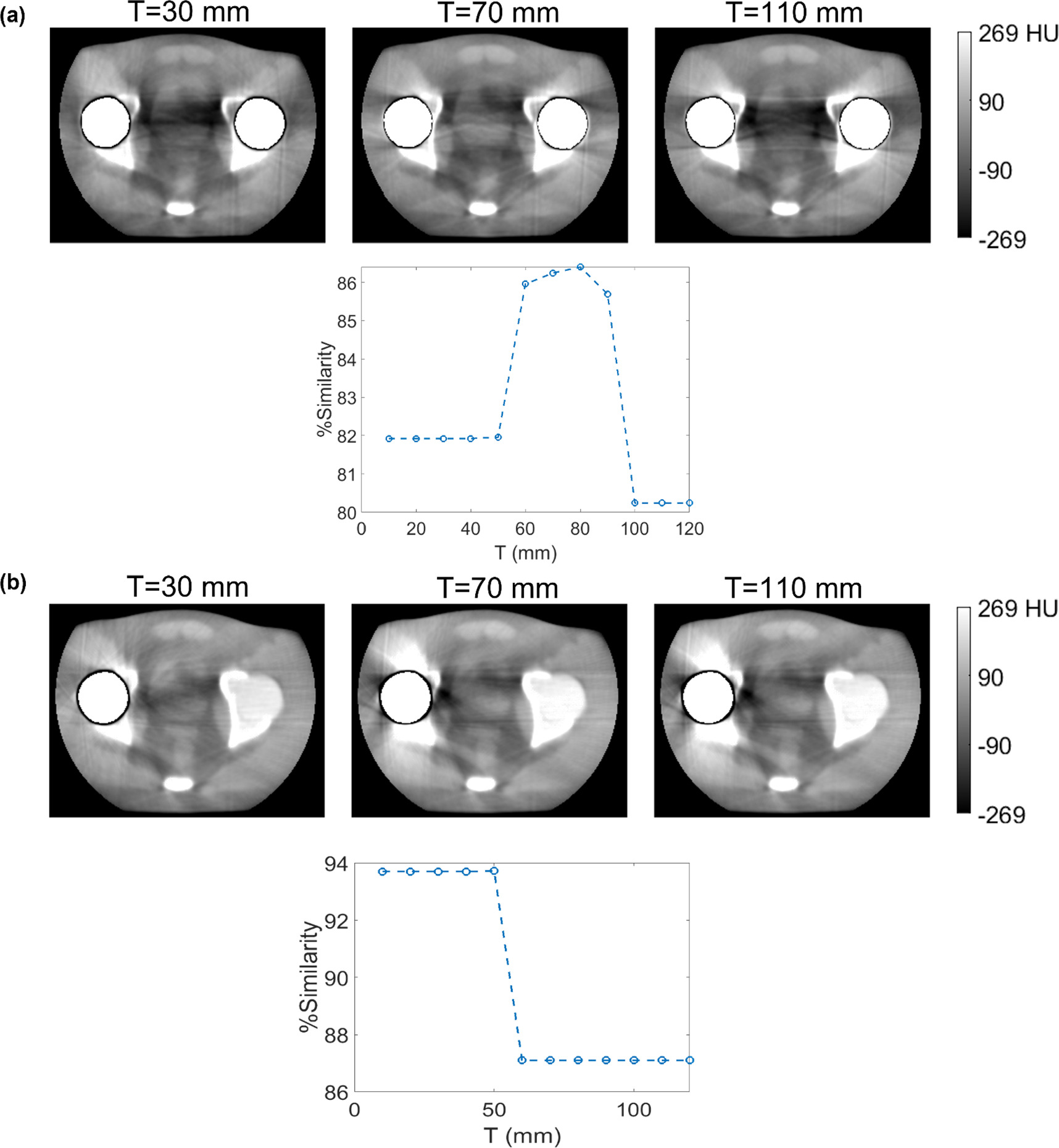 A kV–MV approach to CBCT metal artifact reduction using multi-layer MV ...