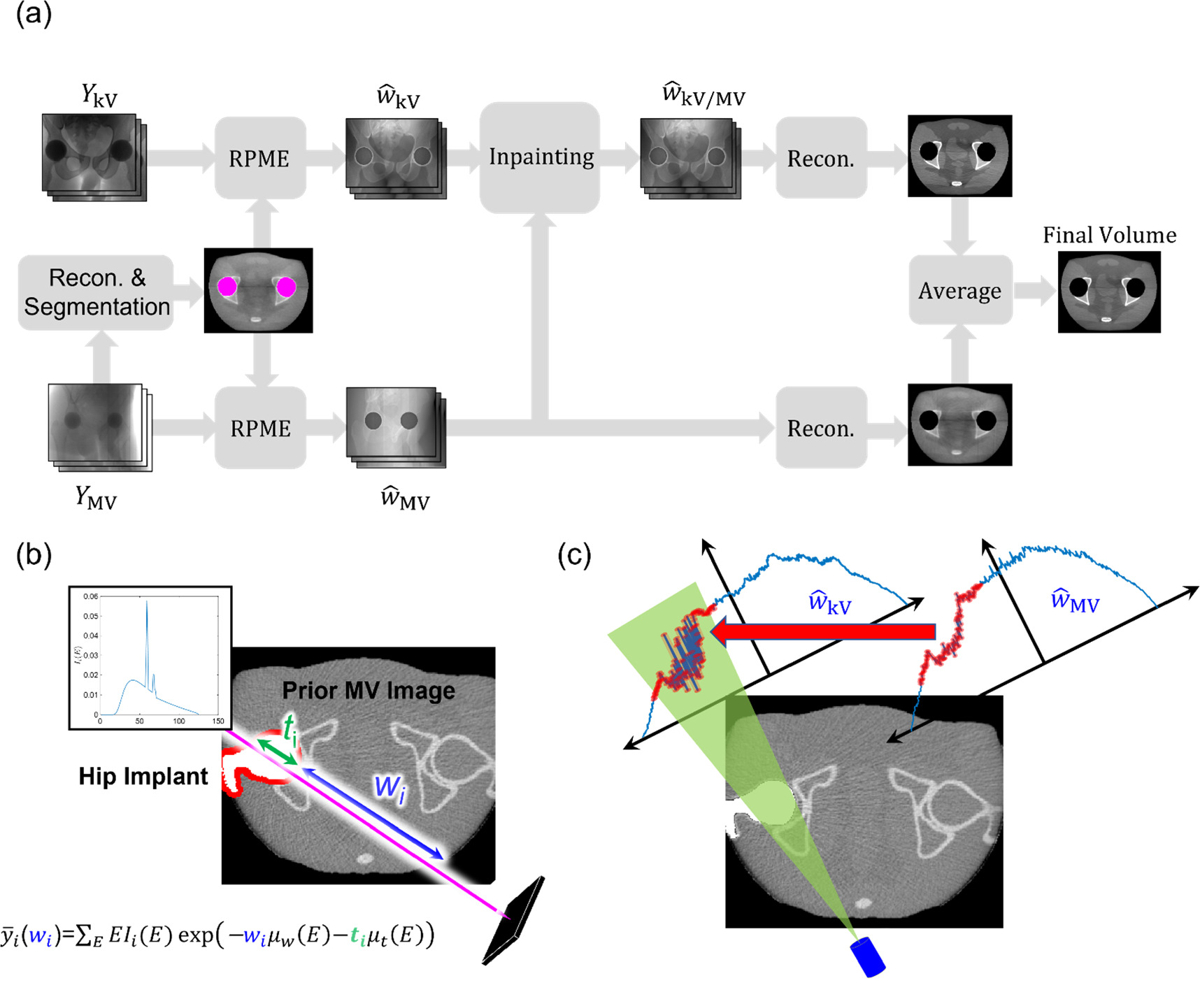 A kV–MV approach to CBCT metal artifact reduction using multi-layer MV ...