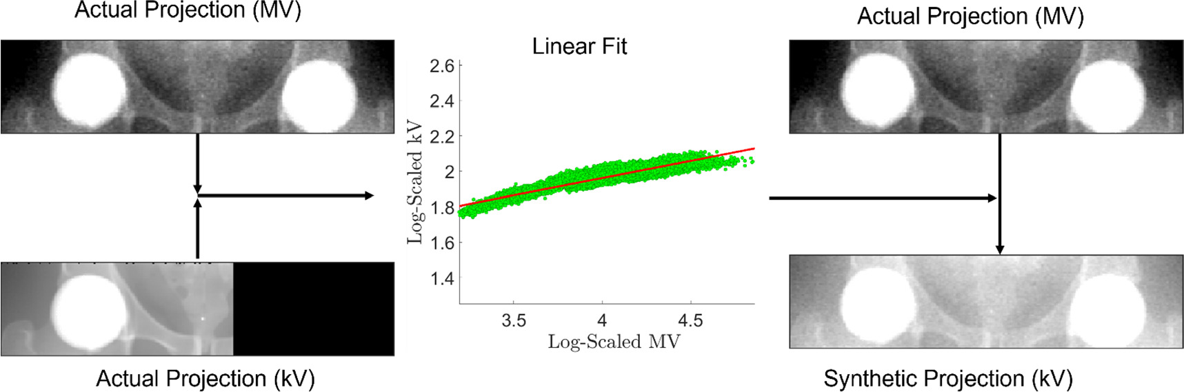 A kV–MV approach to CBCT metal artifact reduction using multi-layer MV-CBCT - IOPscience